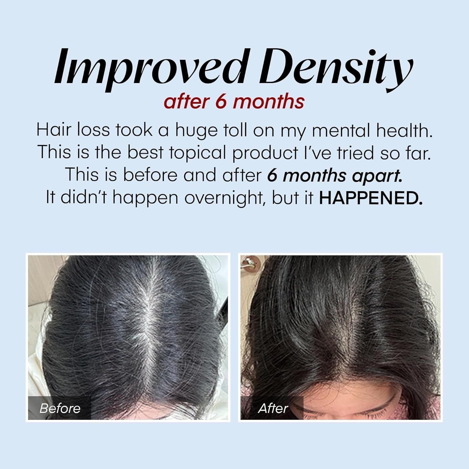 Seapuri Scalpy Hair Ampoule – 20ml | Clinically Proven Hair Growth & S ...